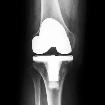 Find the best doctors in Germany - Surgical Experts